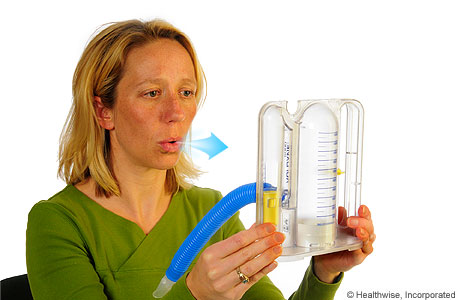 Teleflex Medical Voldyne® Incentive Breathing Exercise Spirometer ...